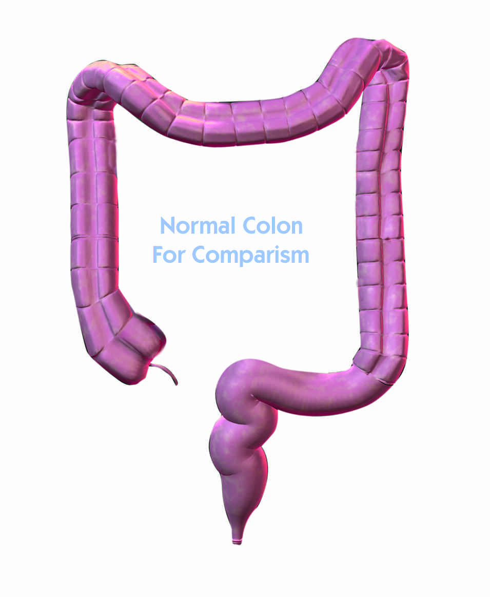 Colon Cleansing – Full Regeneration